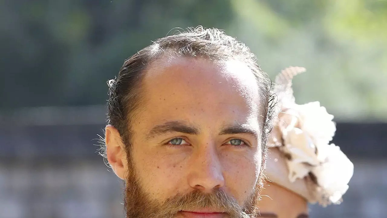 Hogyan készítsd el a tökéletes James Middleton szakállt Harry esküvőjén